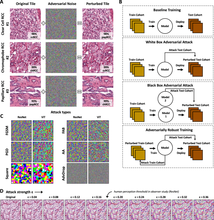 Adversarial attacks and adversarial robustness in computational pathology | 集智斑图