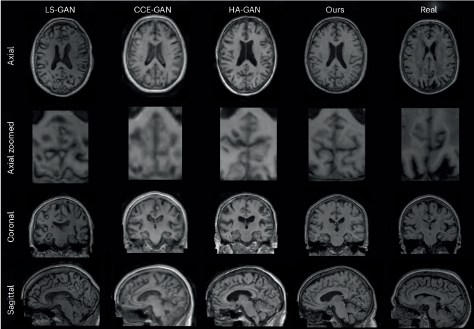 Realistic morphology-preserving generative modelling of the brain | 集智斑图