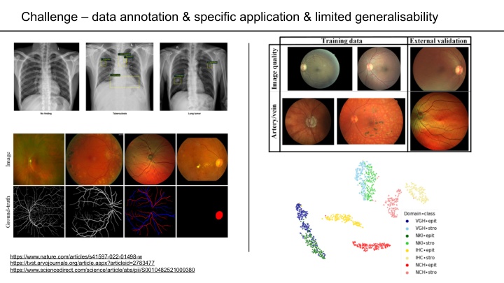 「RETFound：自我监督学习驱动的视网膜图像AI模型及其跨领域应用」核心术语与资源汇总 | 集智斑图